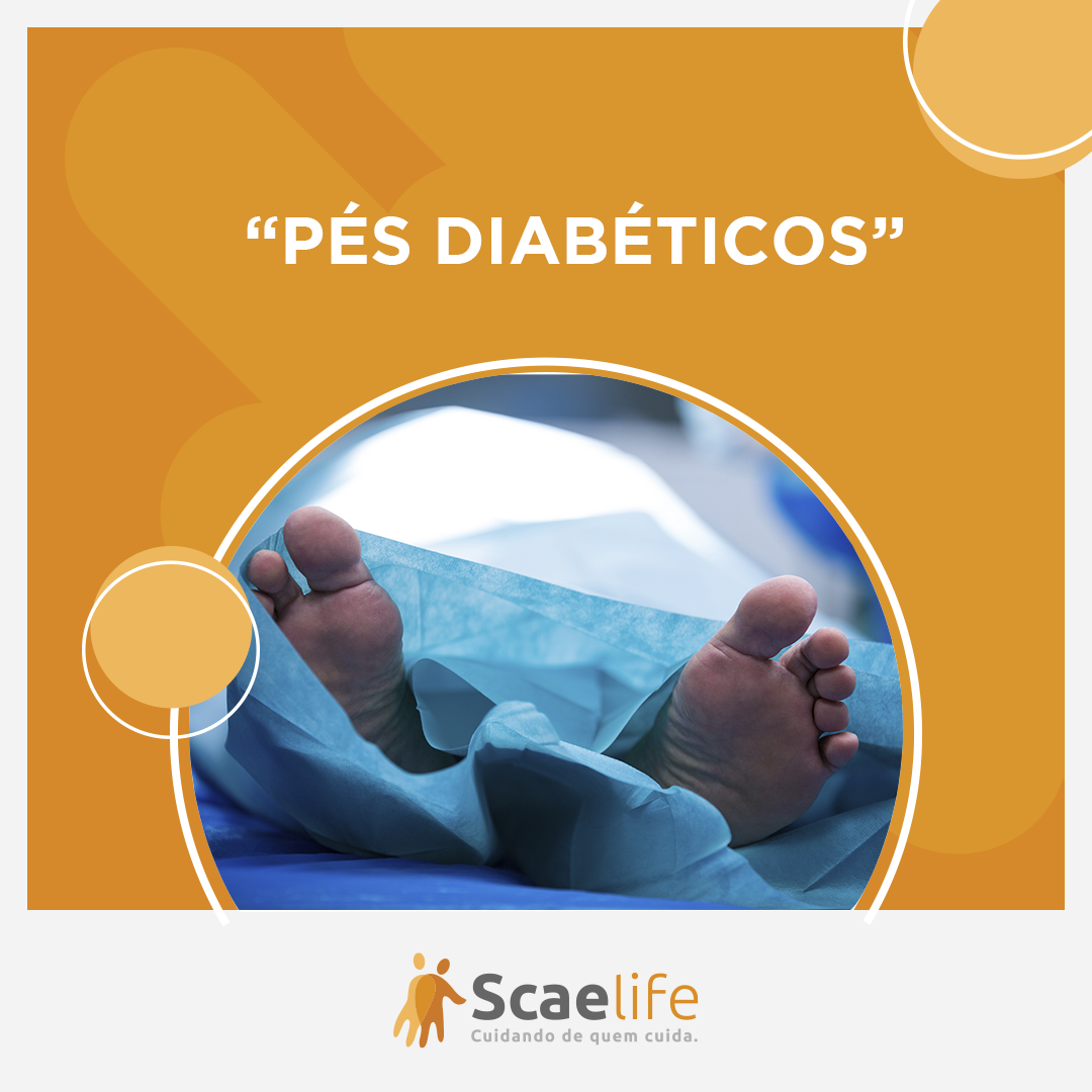 Blog da Gigi | ATENÇÃO AOS PÉS DOS PACIENTES DIABÉTICOS
